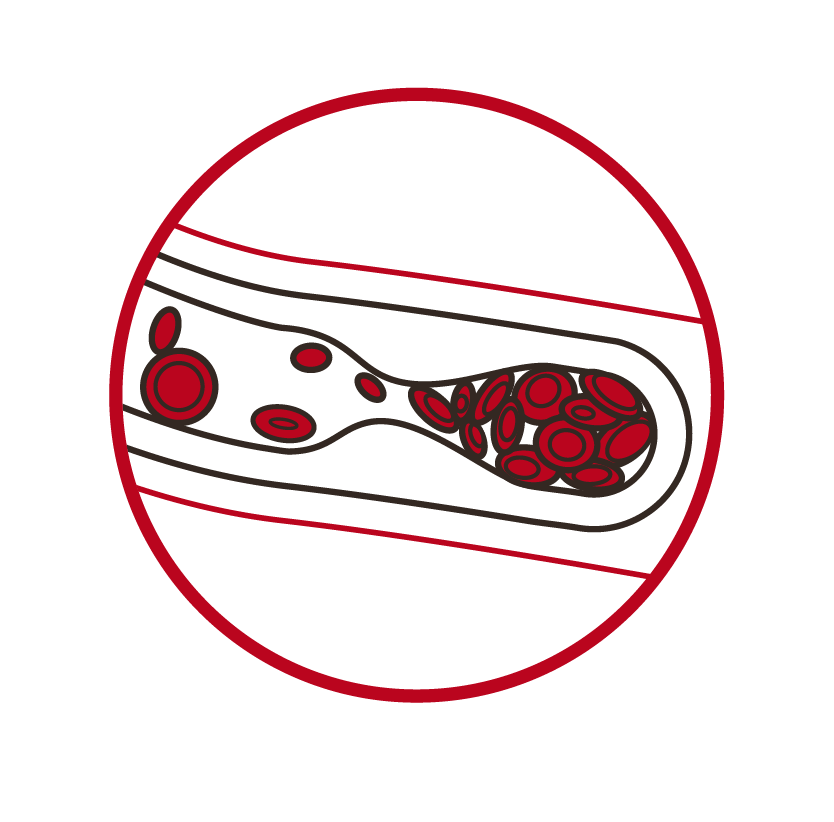 Thrombotic Disorders | Haematology Clinic